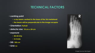 X-RAY views for foot, calcaneum, and ankle joint. | PDF