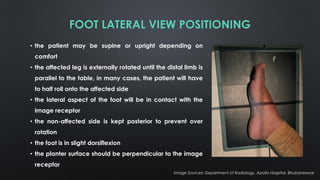 X-RAY views for foot, calcaneum, and ankle joint. | PDF