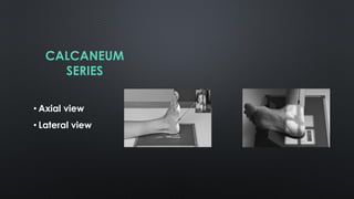X-RAY views for foot, calcaneum, and ankle joint. | PDF