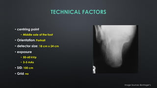 X-RAY views for foot, calcaneum, and ankle joint. | PDF