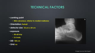 X-RAY views for foot, calcaneum, and ankle joint. | PDF