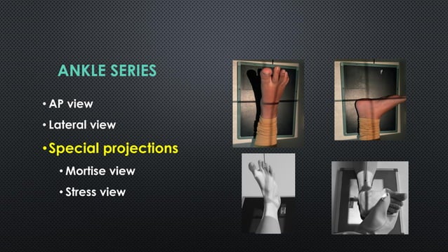 X-RAY views for foot, calcaneum, and ankle joint. | PDF