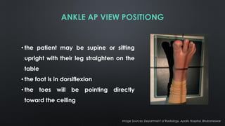 X-RAY views for foot, calcaneum, and ankle joint. | PDF