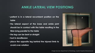 X-RAY views for foot, calcaneum, and ankle joint. | PDF