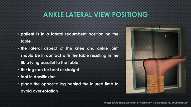 X-RAY views for foot, calcaneum, and ankle joint. | PDF