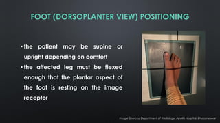 X-RAY views for foot, calcaneum, and ankle joint. | PDF