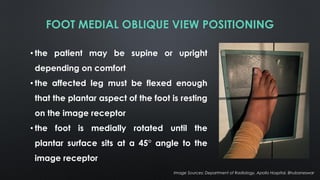 X-RAY views for foot, calcaneum, and ankle joint. | PDF
