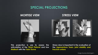 X-RAY views for foot, calcaneum, and ankle joint. | PPT