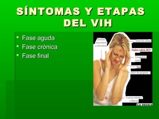 Vih (virus de la inmunodeficiencia humana) | PPT