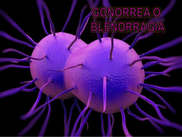 VIH, VPH Y GONORREA O BLENORRAGIA