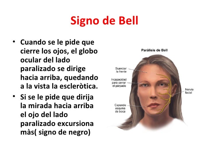 Vii par nervio facial