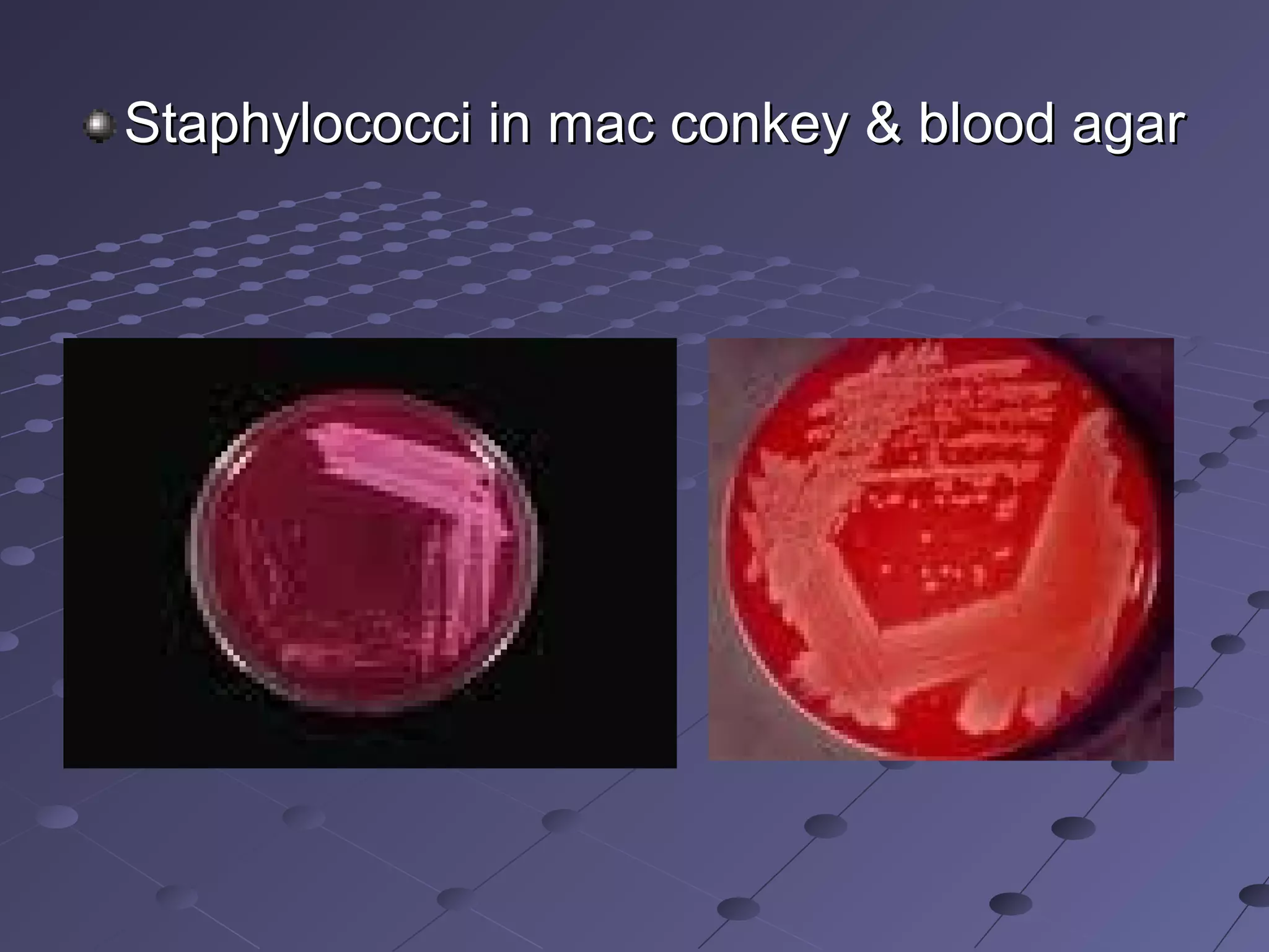 Viji presentation 1 | PPT