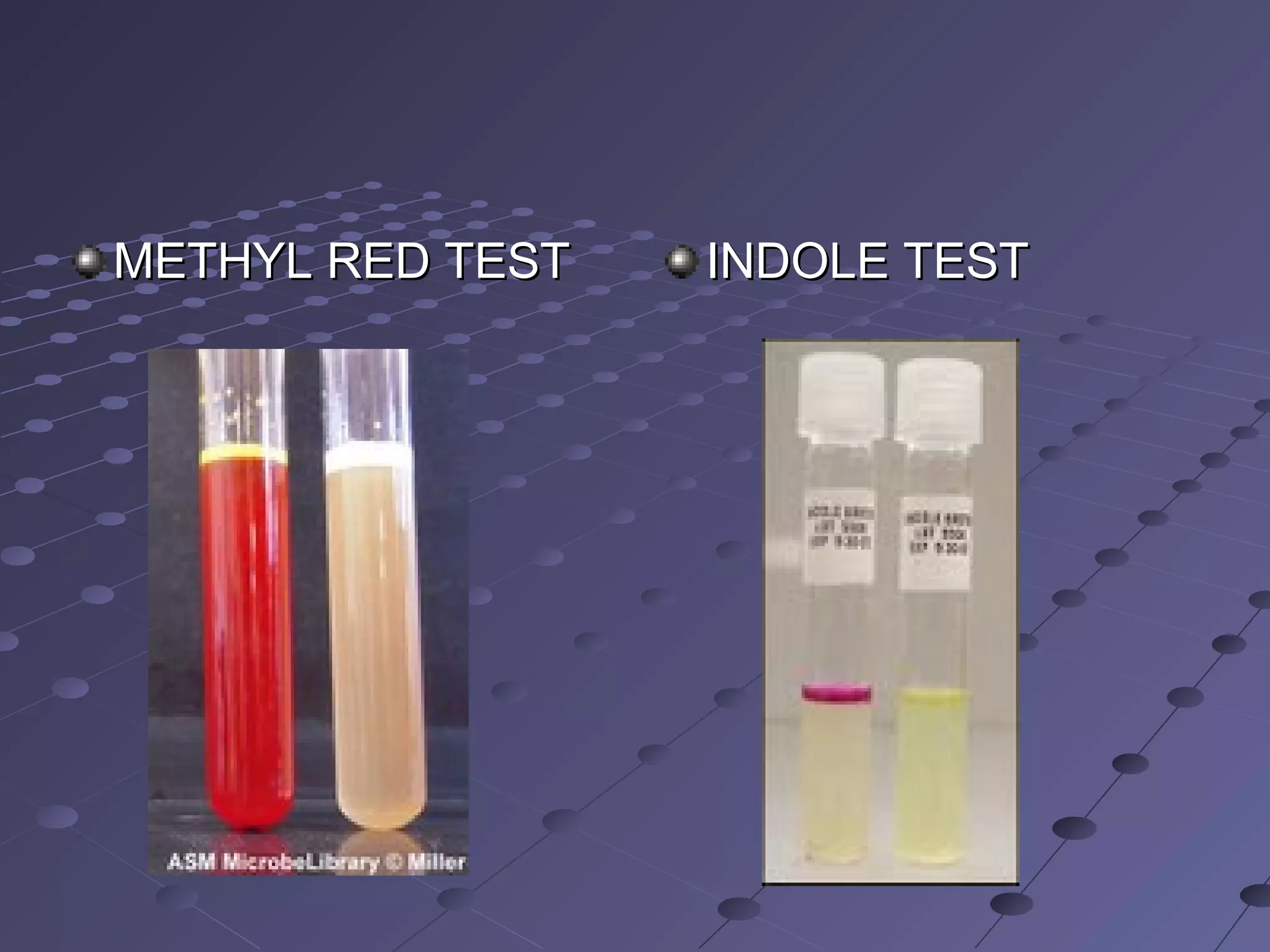 Viji presentation 1 | PPT