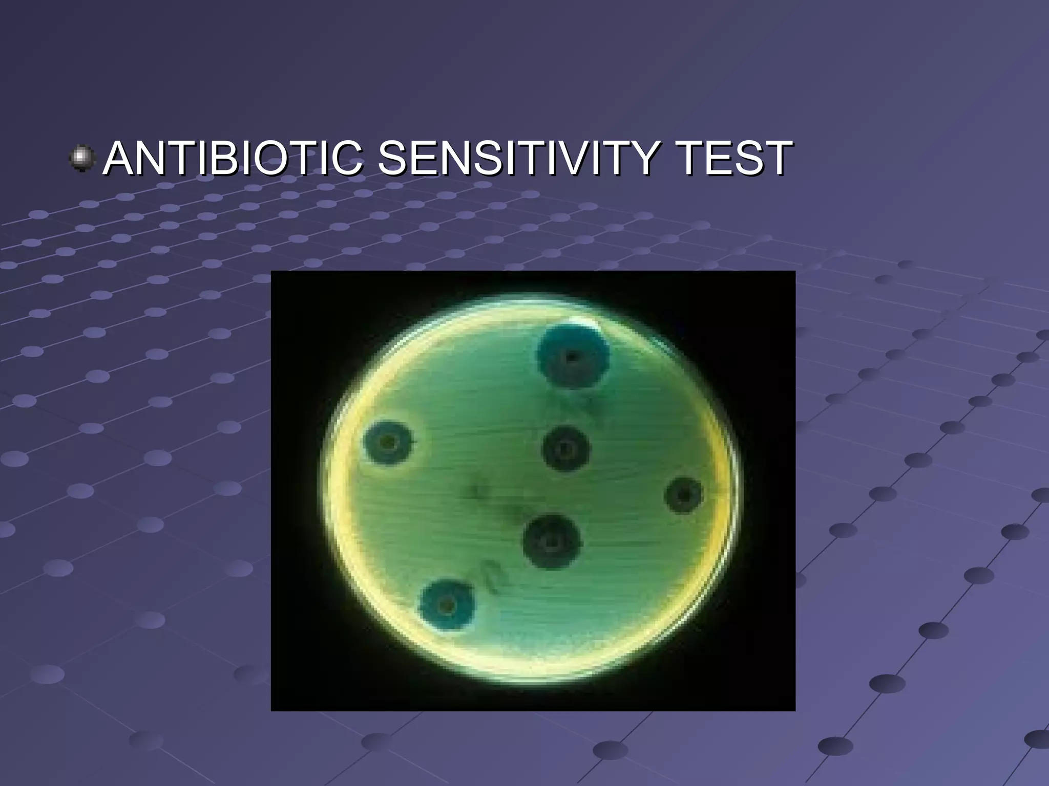 Viji presentation 1 | PPT