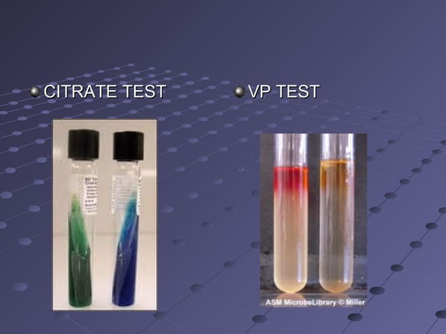 Viji presentation 1 | PPT