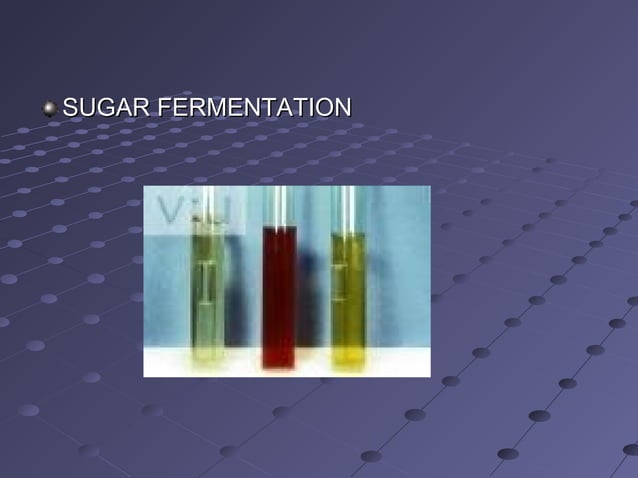 Viji presentation 1 | PPT