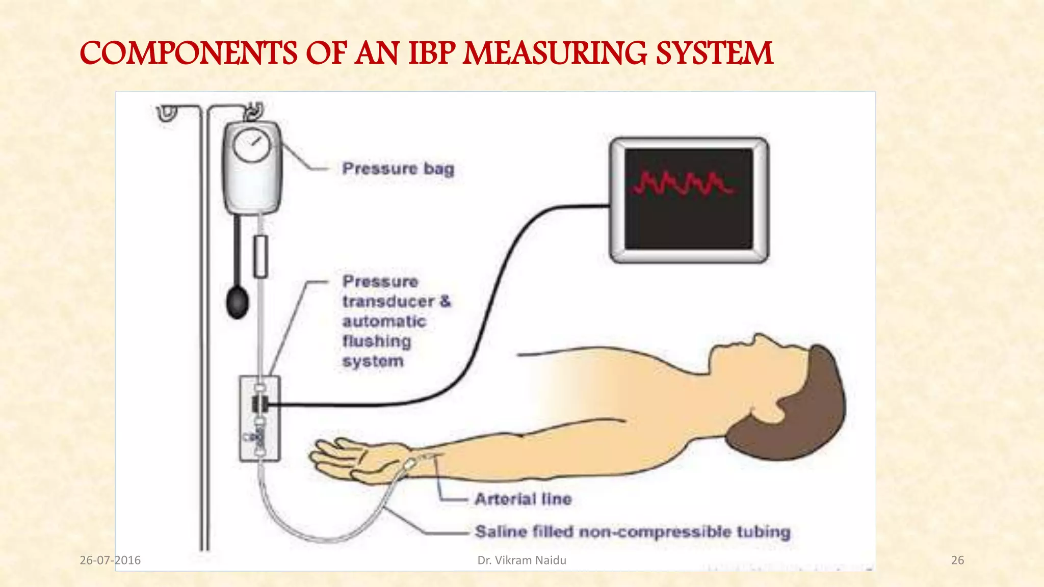 INTRA-ARTERIAL BLOOD PRESSURE MONITORING | PPTX