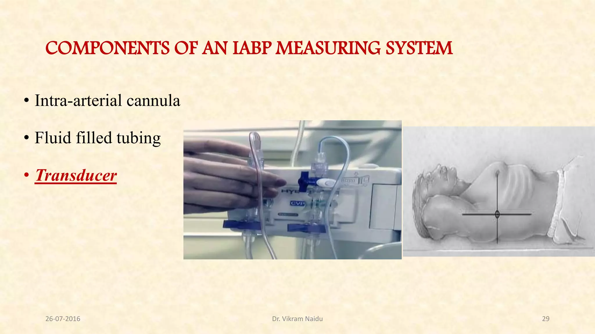 INTRA-ARTERIAL BLOOD PRESSURE MONITORING | PPTX