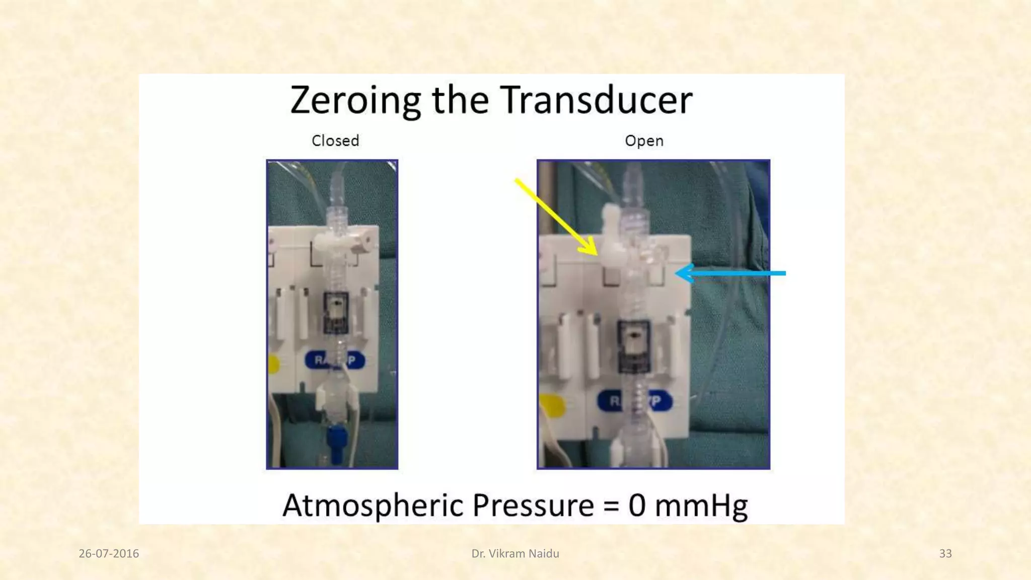 INTRA-ARTERIAL BLOOD PRESSURE MONITORING | PPTX