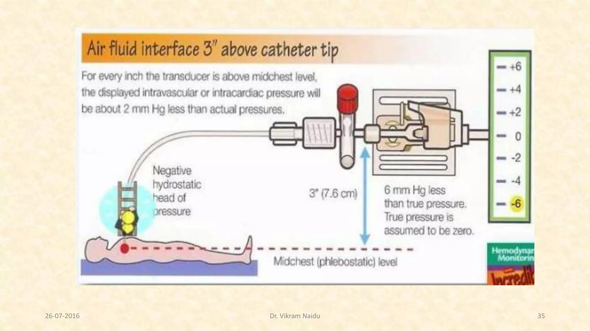 INTRA-ARTERIAL BLOOD PRESSURE MONITORING | PPTX