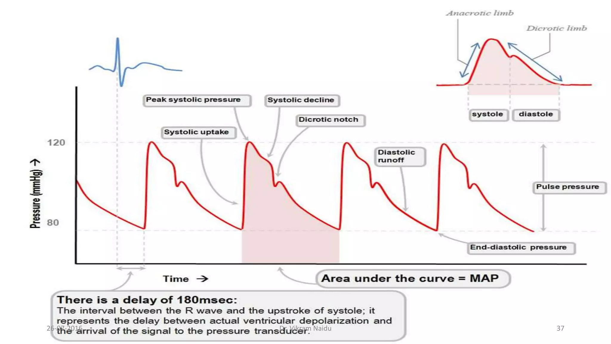 INTRA-ARTERIAL BLOOD PRESSURE MONITORING | PPTX