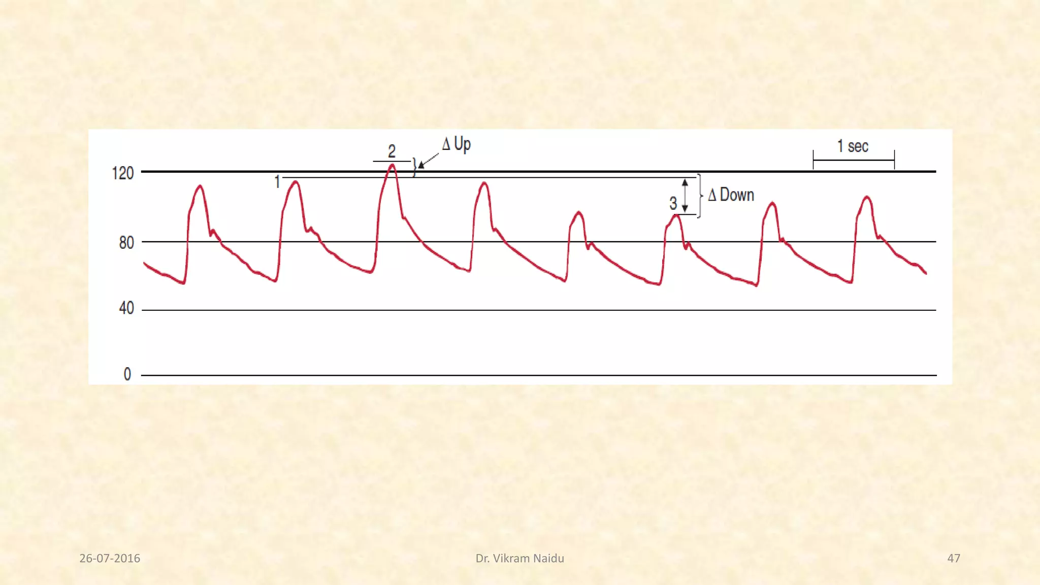 INTRA-ARTERIAL BLOOD PRESSURE MONITORING | PPTX