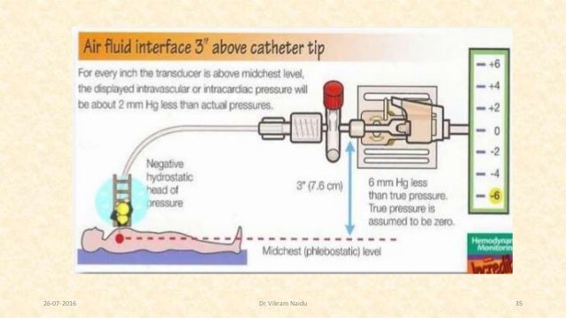 INTRA-ARTERIAL BLOOD PRESSURE MONITORING