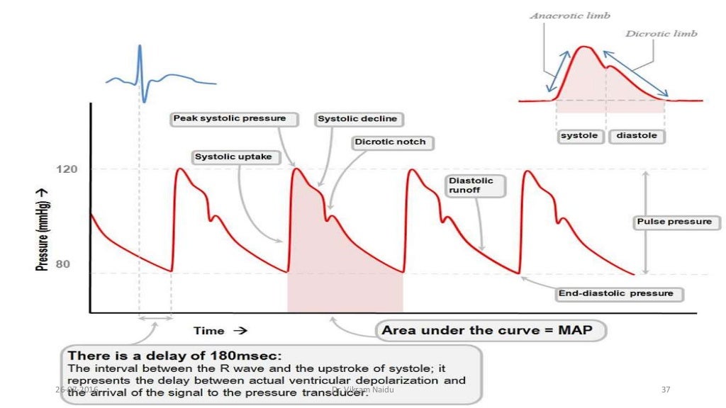 INTRA-ARTERIAL BLOOD PRESSURE MONITORING