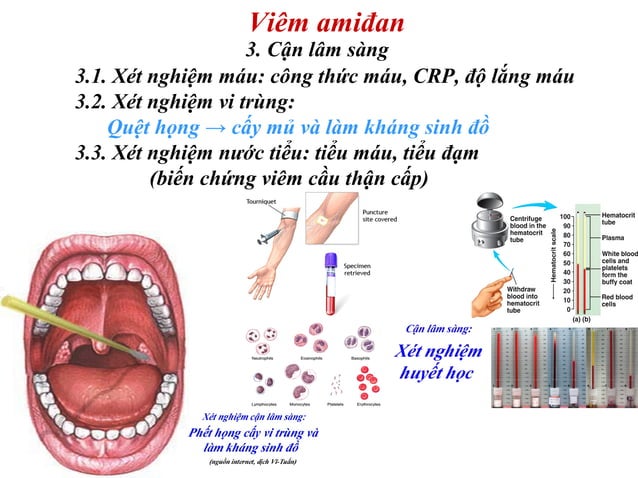 Viêm amidan Bài giảng đại họ Y khoa Phạm Ngọc Thạch | PPT