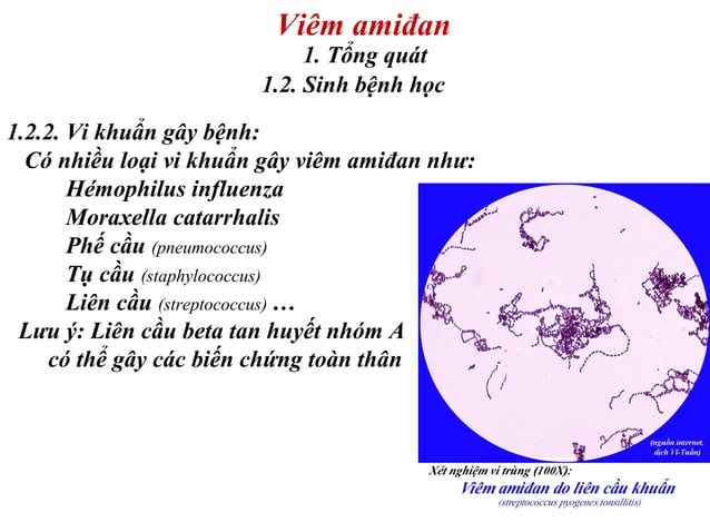 Viêm amidan Bài giảng đại họ Y khoa Phạm Ngọc Thạch | PPT