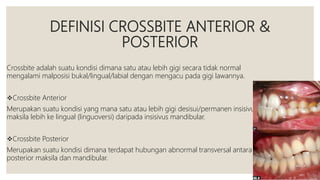 Tutorial Maloklusi & Crossbite | PPTX