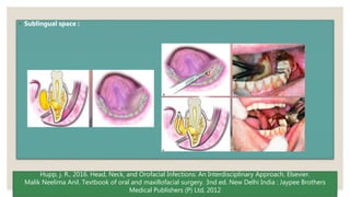 Infeksi Odontogenik | PPTX