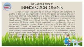 Infeksi Odontogenik | PPTX