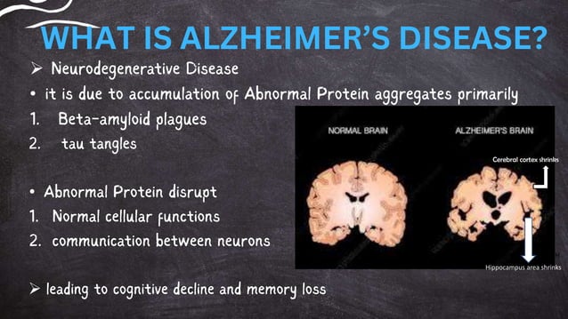 Alzheimer's disease | PPT
