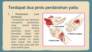 ini adalah contoh presentasi dengan judul pertolongan pertama | PPTX