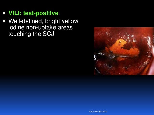 Visual inspection of cervix