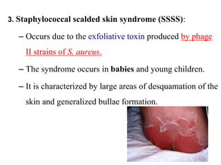 Chapter_4_Pathogenic_Gram_positive_cocci.pptx