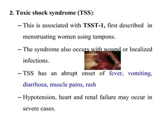 Chapter_4_Pathogenic_Gram_positive_cocci.pptx