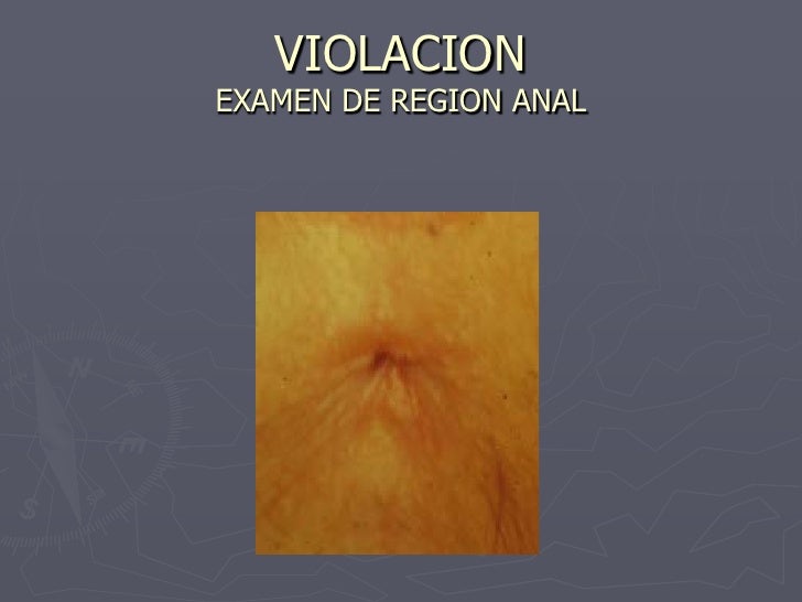 Violacion