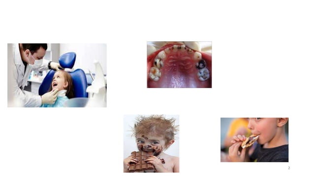 Vipeholm upload.pptx | Dental Health | Diseases and Conditions
