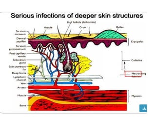 Clinical approach and principle of management of cellulitis and ...