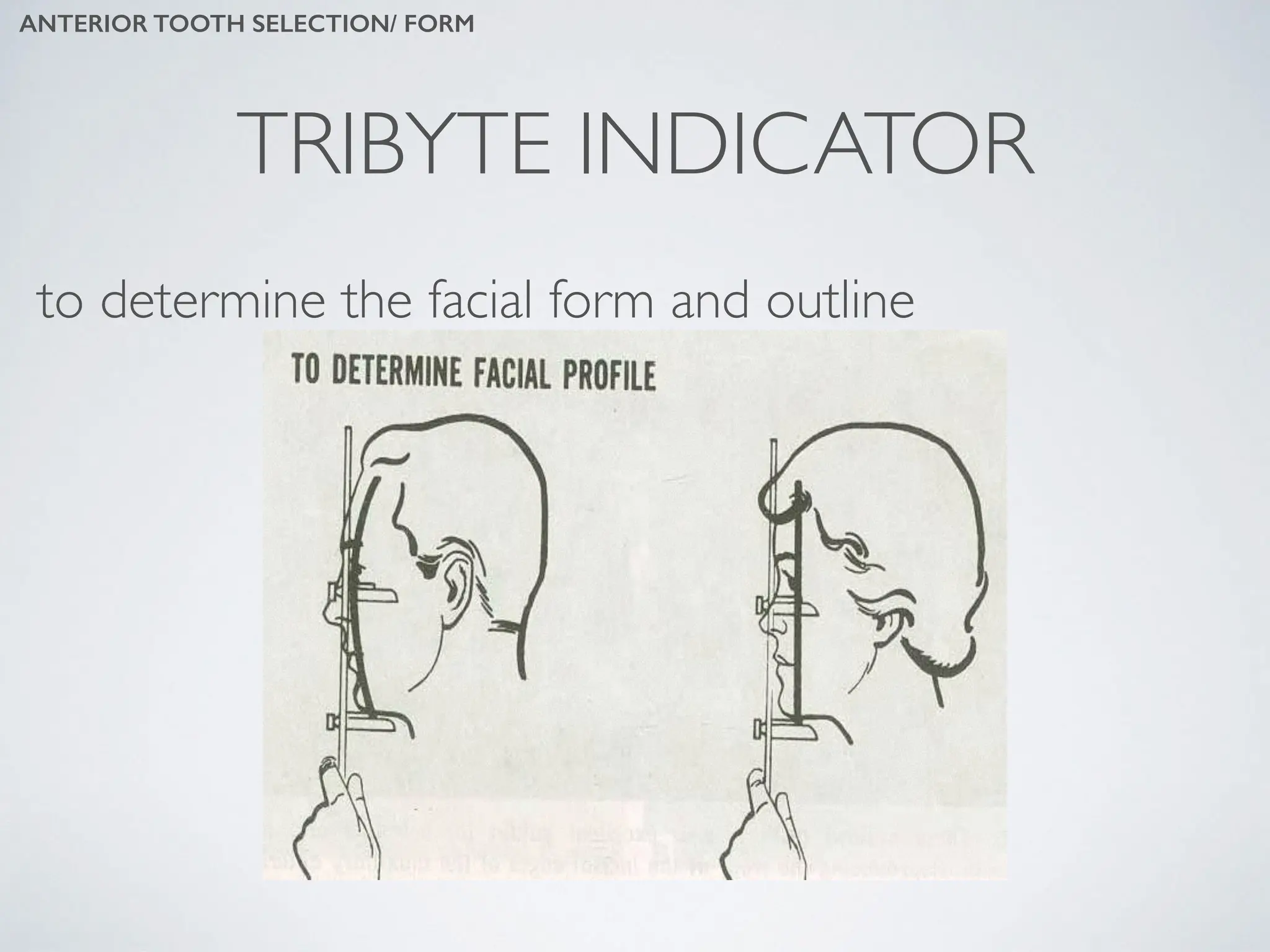 SELECTION-AND-ARRANGEMENT-OF-ARTIFICIAL-TEETH-FOR-DENTURE-PROSTHESIS 2.pdf