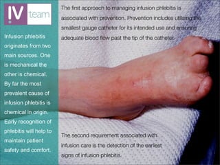 Infiltration Vs Phlebitis