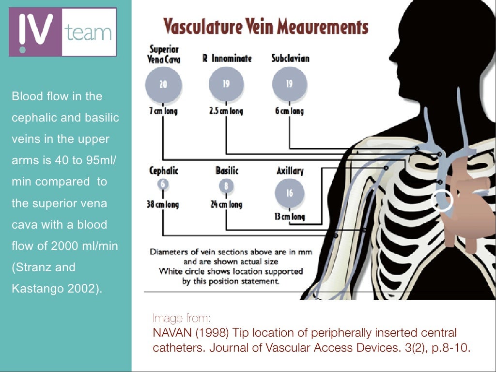 Introduction to the Visual Infusion Phlebitis (VIP) score