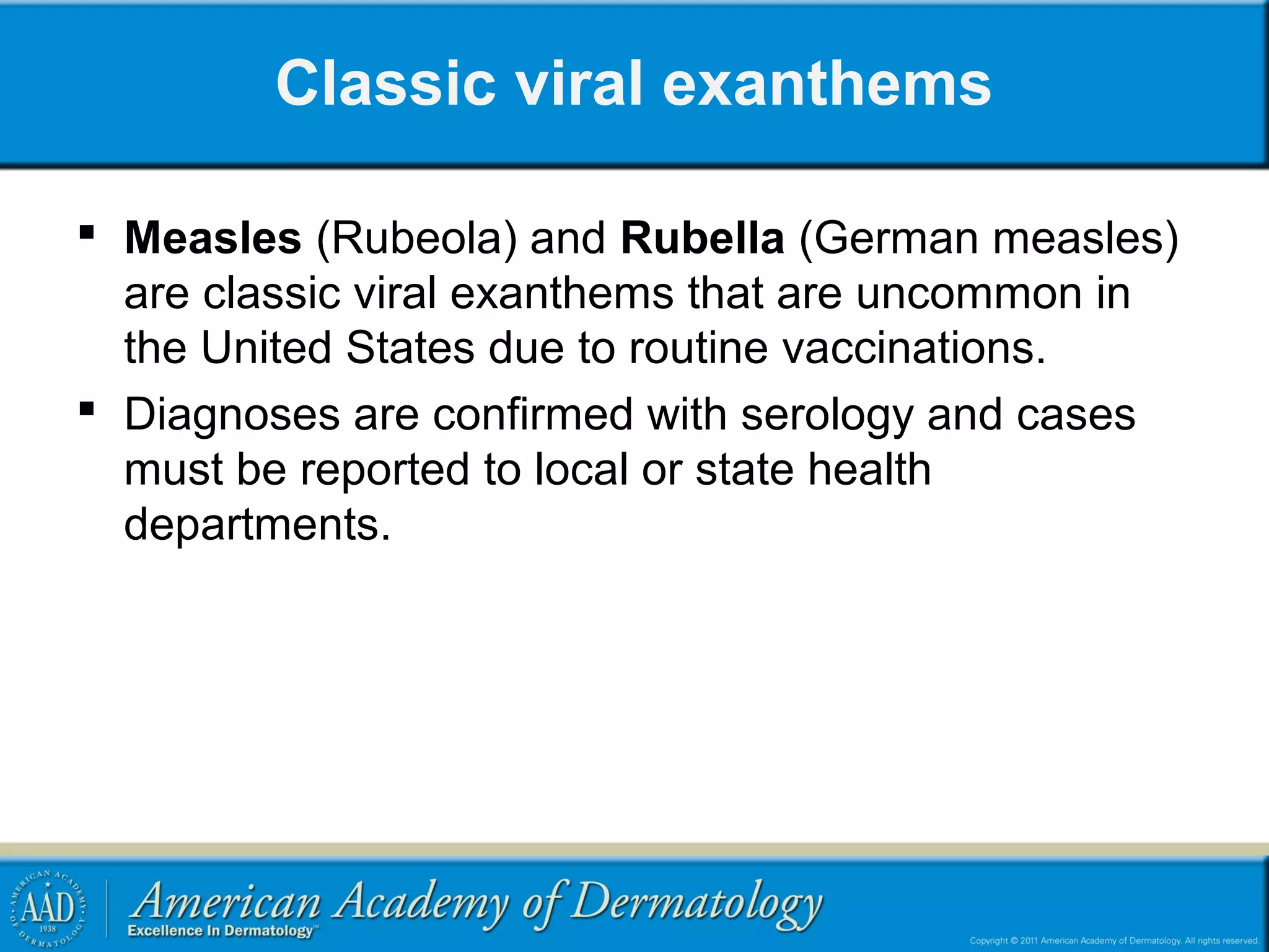 Viral exanthems | PPT