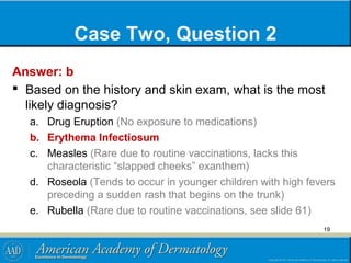 Viral Exanthem Chart