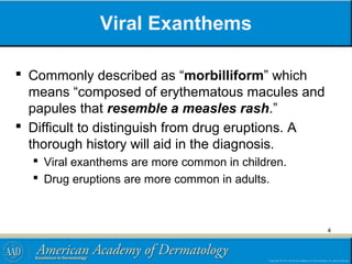 Viral Exanthem Table