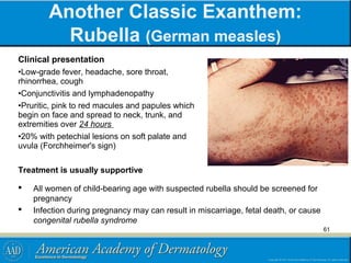 Viral Exanthem Rash Contagious