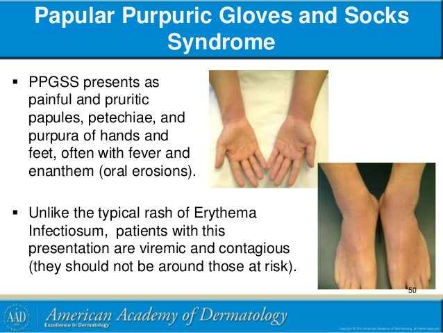 Viral exanthems-module
