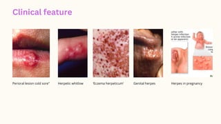 viral-infections.pdf